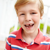 I lost another tooth! | Buy Stock Photo on PeopleImages, Picture And ...