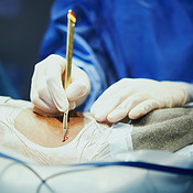 Making the perfect incision | Buy Stock Photo on PeopleImages, Picture ...