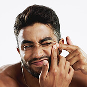 Pimple pop, Indian man and struggling model doing skincare and wellness ...