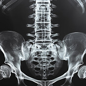 Closeup, xray and pelvis bone scan, healthcare and orthopedic surgery ...