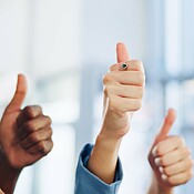 Employees, hands and thumbs up in office for approval, team support and ...