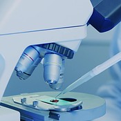 Closeup of a blood sample on glass plate under microscope lense ...