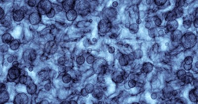 Microscope, virus and zoom of bacteria science technology in medical ...