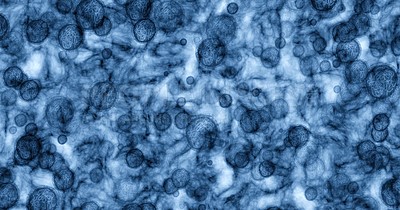 Bacteria particles, microscope and molecule zoom for science, biology ...