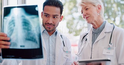 X ray, consulting and teamwork of doctors in hospital with tablet ...